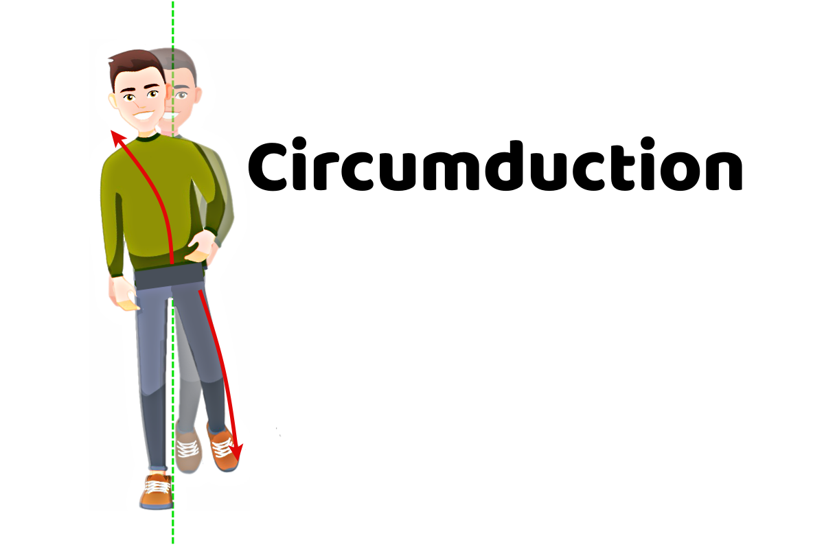 5 Problems That Lead To Circumduction Rehab HQ
